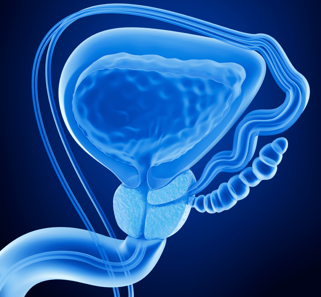 Hereditary Prostate Cancer: What You Need To Know - Ironwood Cancer ...