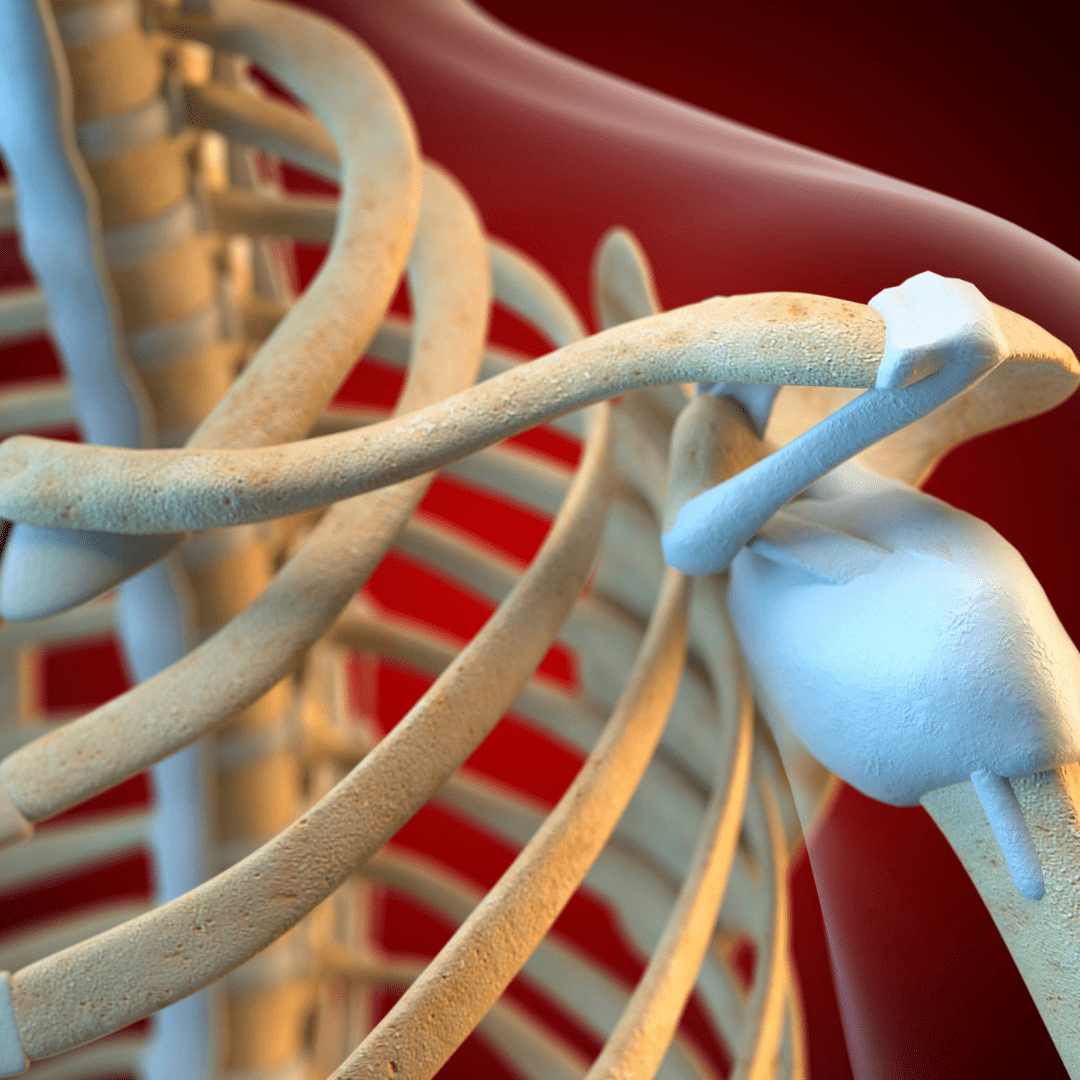 Top 5 supplements for bone health - Ironwood Cancer & Research Centers